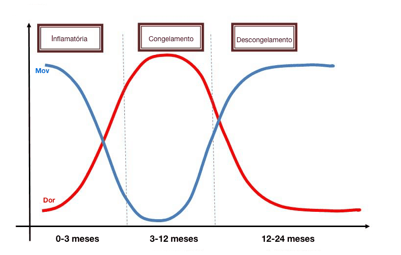 Capsulite Adesiva: O que é, Causas, Sintomas, Tratamentos e Cirurgias ...